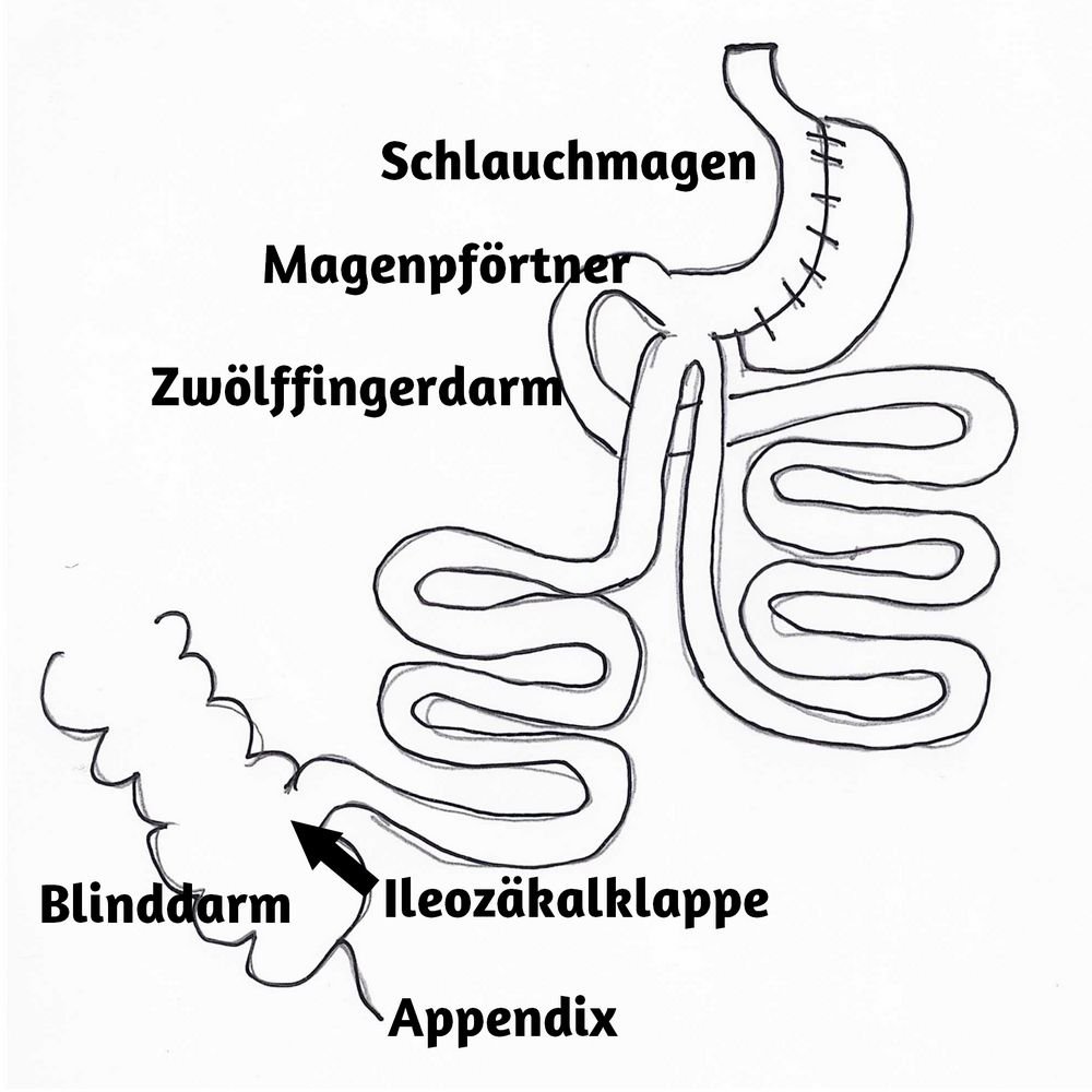 [Teil 2] SASI – die Operation - Happy End Kurven
